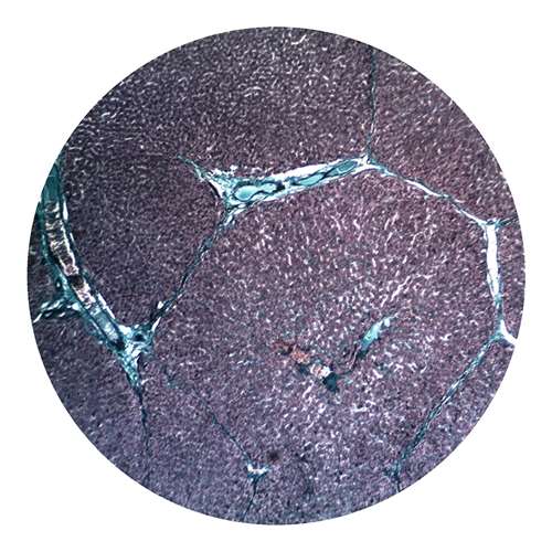 Liver of Pig, VS showing Lobules & Glisson's Capsule | School Science ...